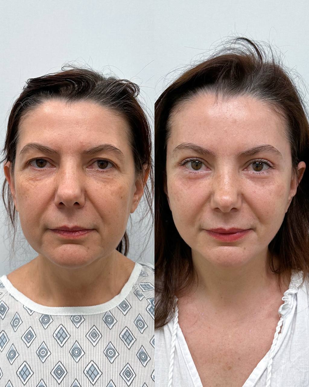 Telegram-канал "Doctor.rust" — @doctor_rust — TGStat